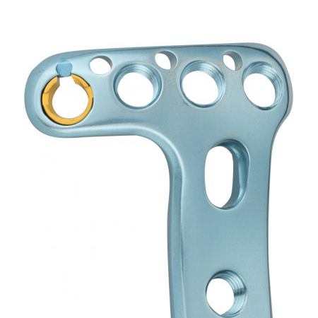 4.0 Medial tibia plateau locking plate(Variable angle) ID - 397 40119